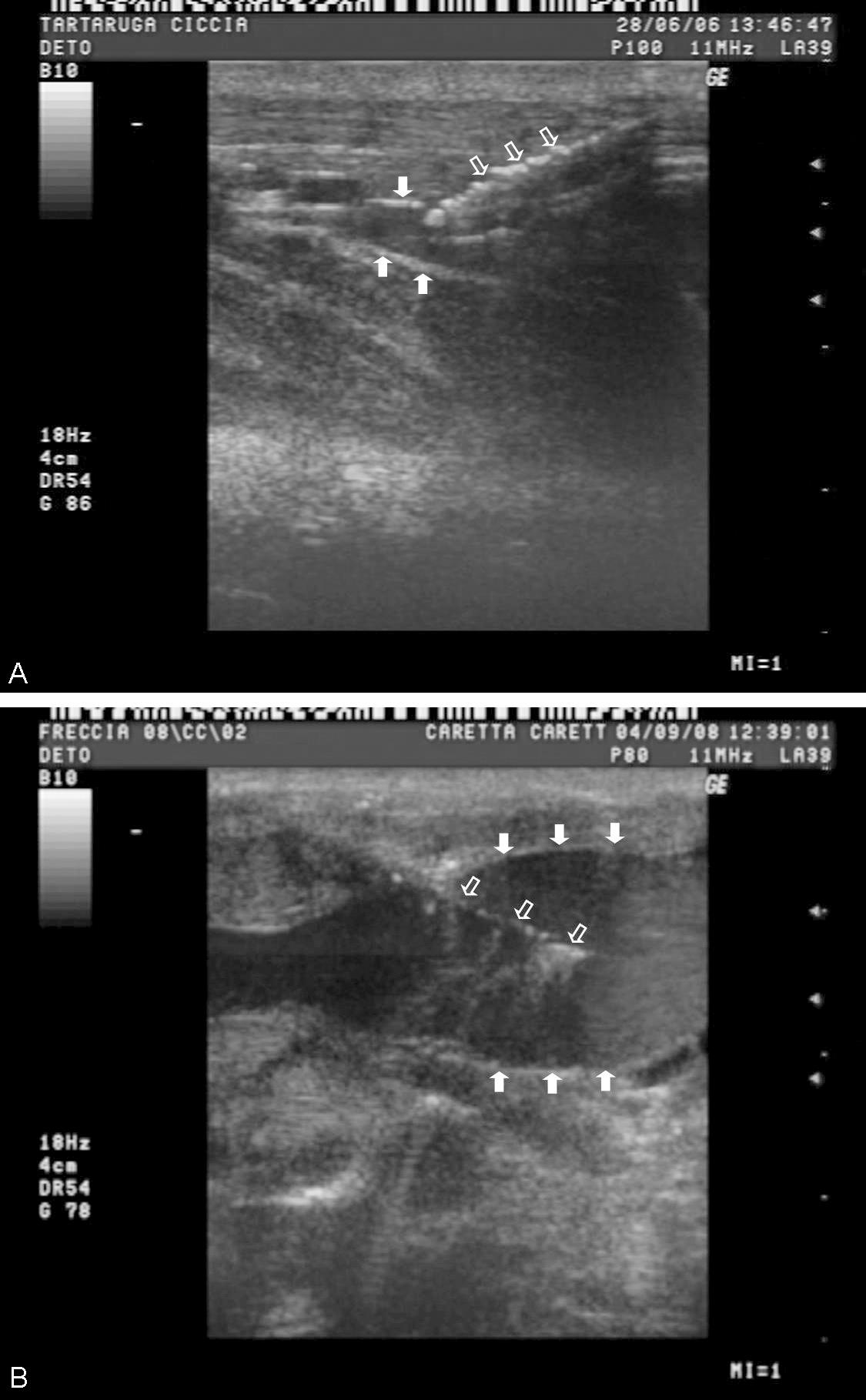 Ultrasound-Guided Vascular Catheterization in Loggerhead Sea Turtles ...